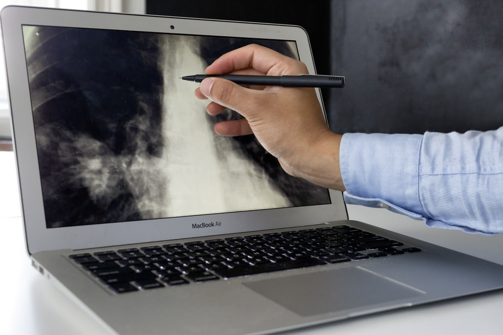 When You Get Blindsided by “It” - Reframing Ministries